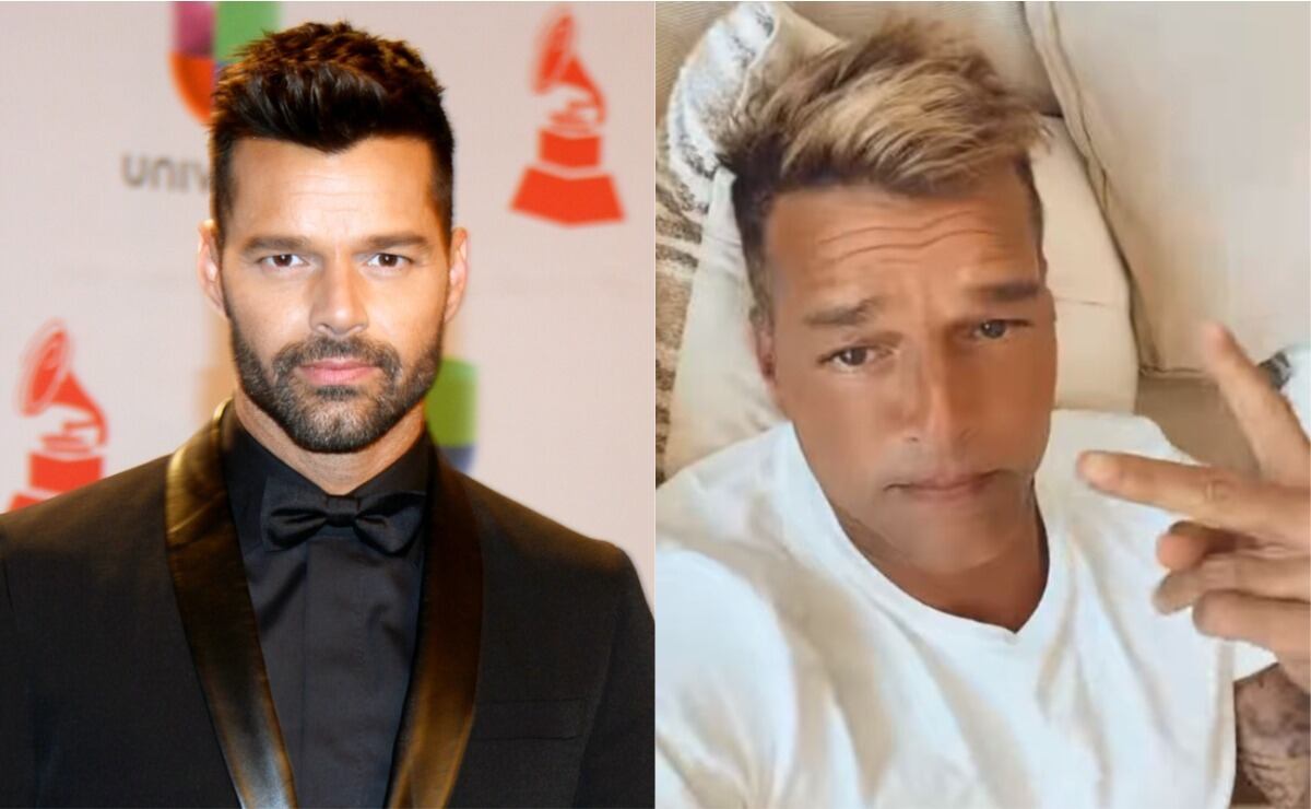 ¿Qué le pasó a Ricky Martin en el rostro? Así luce el cantante hoy